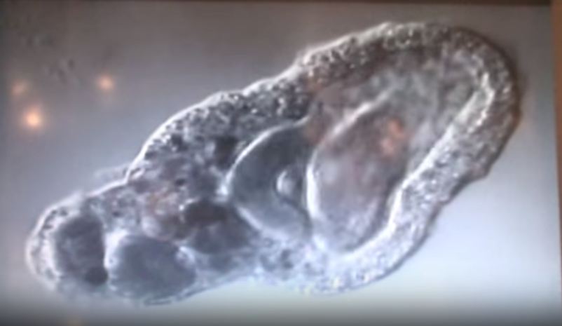 Why Governments Are Like An Ameba | Armstrong Economics